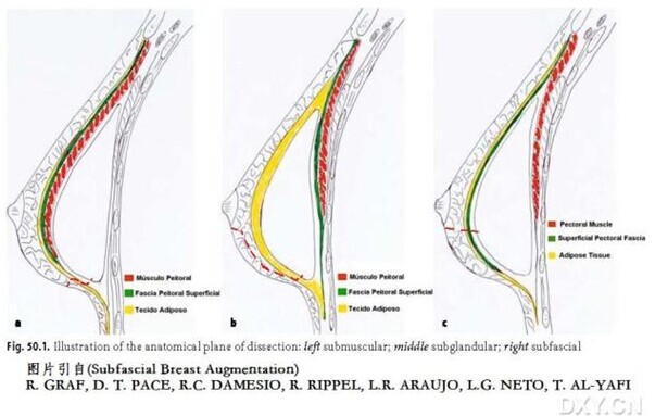 The Overlap Technique