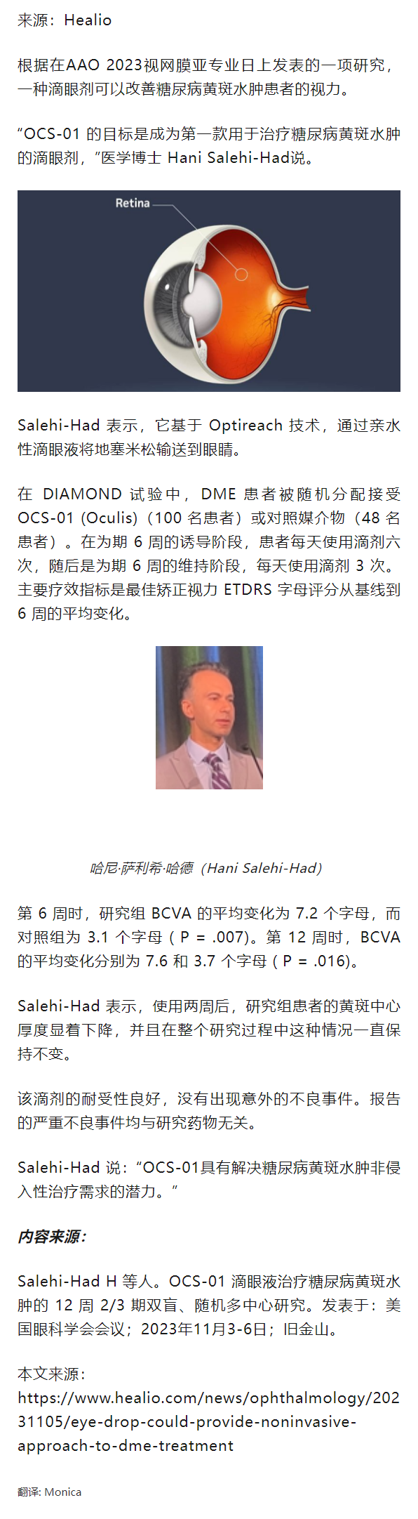 【国际】AAO 2023：OCS-01滴眼剂可为糖尿病黄斑水肿（DME）治疗提供无创方法_www.yanke360.com